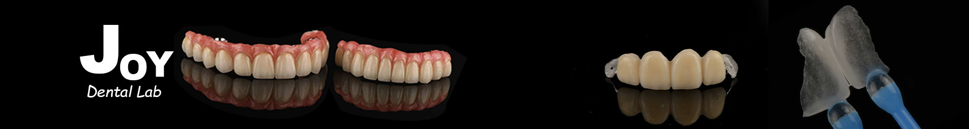 Do Fixed Restorations Require Follow-Up Appointments?