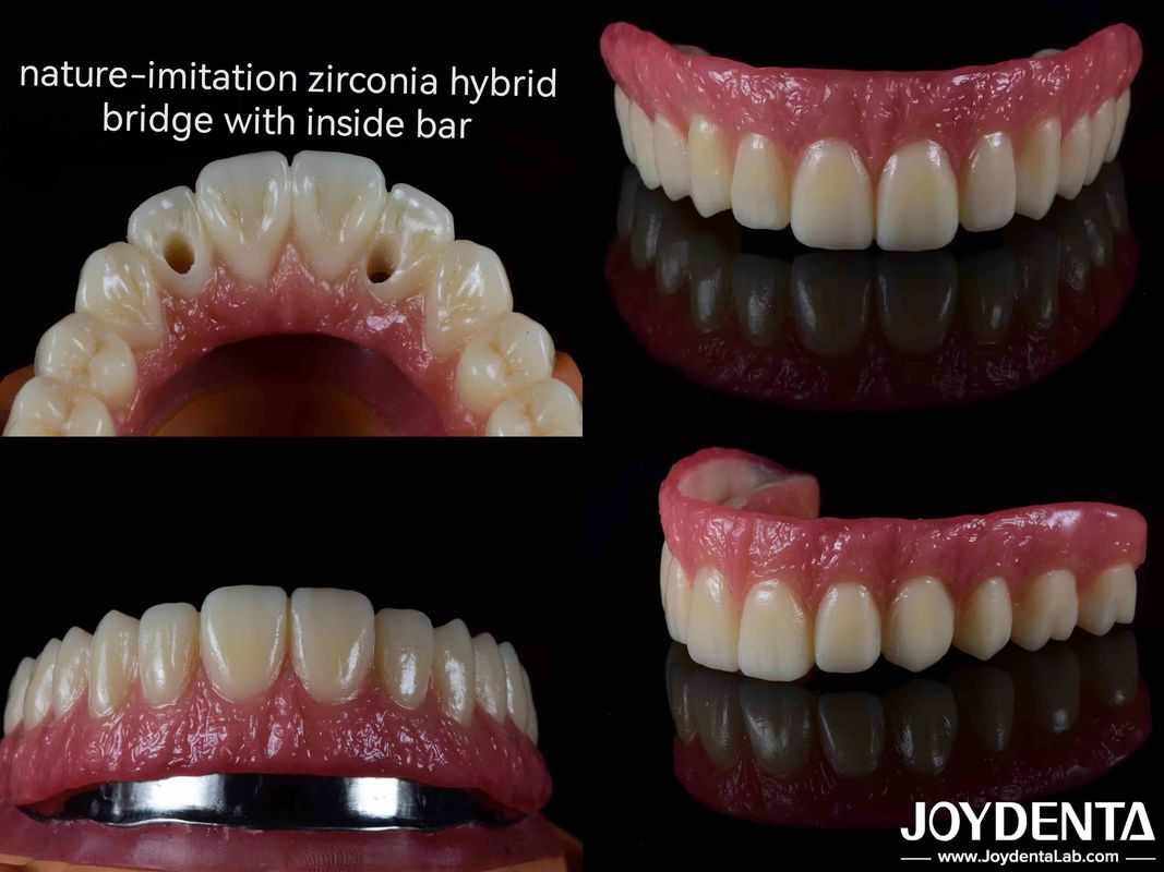 Clear And Mild Odor Ti-Bar Acrylic Teeth Finish For Dental Solution