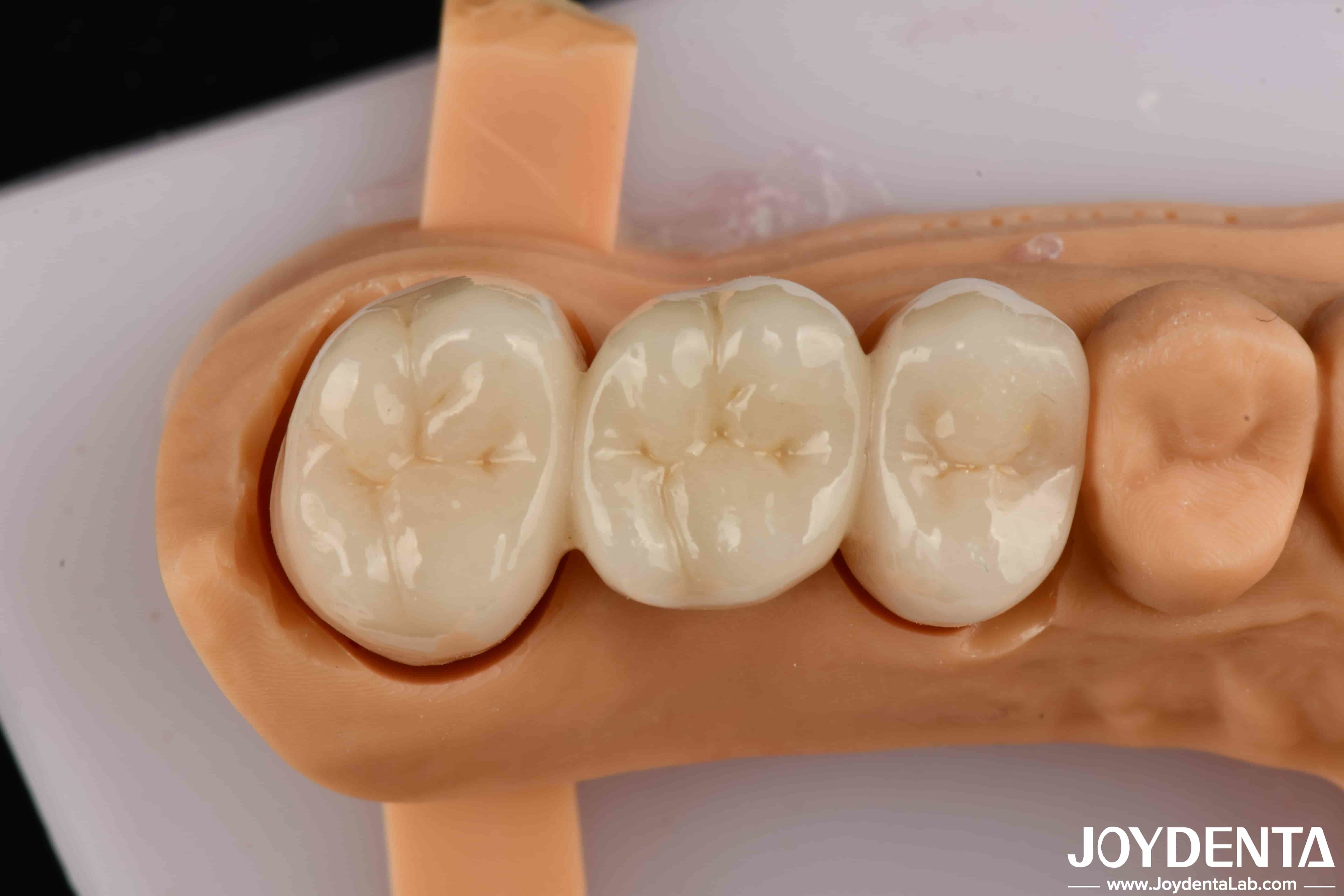 High Flexural Strength Full Contour Zirconia For Crowns Bridges Dental ...