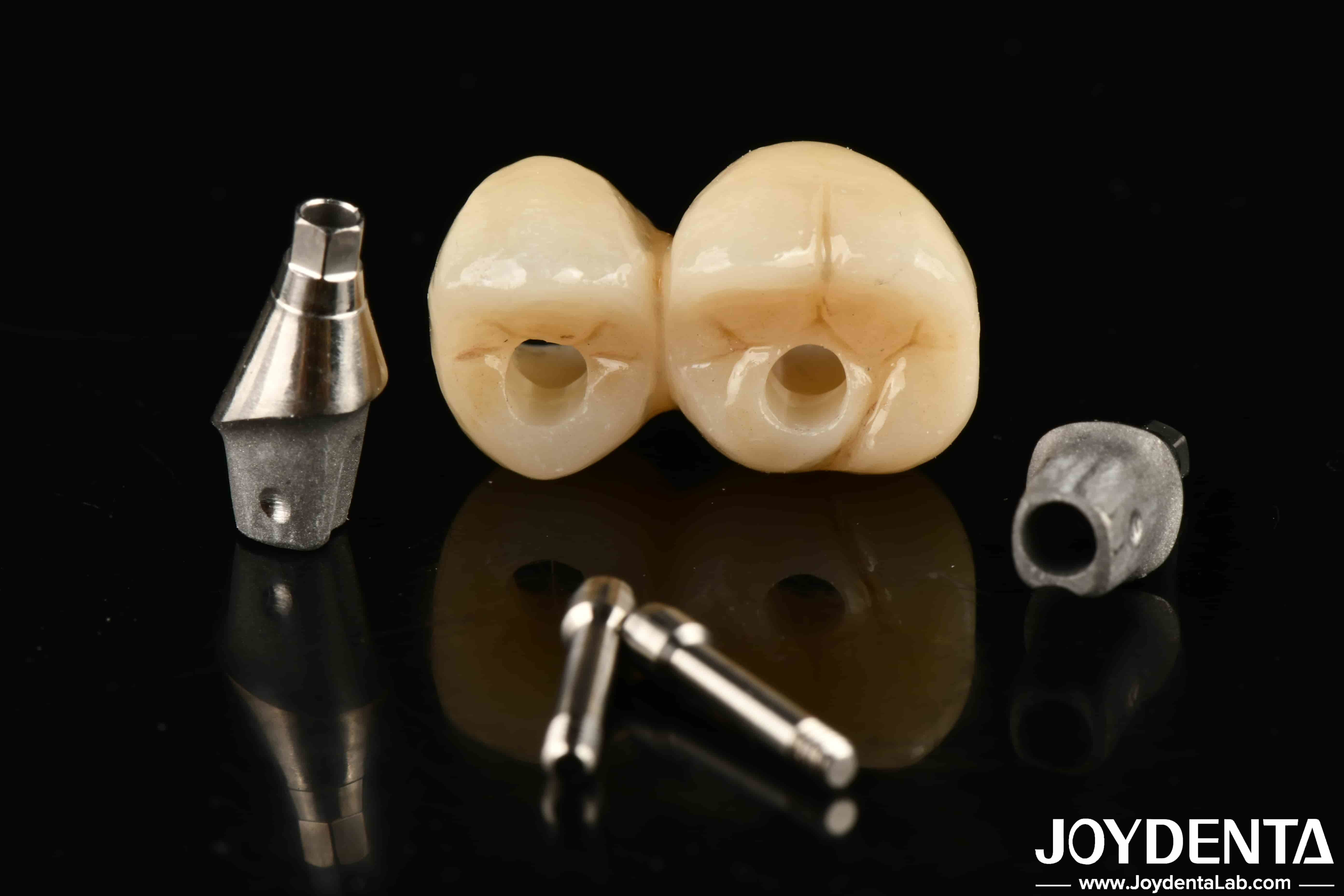 Customizable Porcelain Dental Implant Supported Bridge And Crown For ...